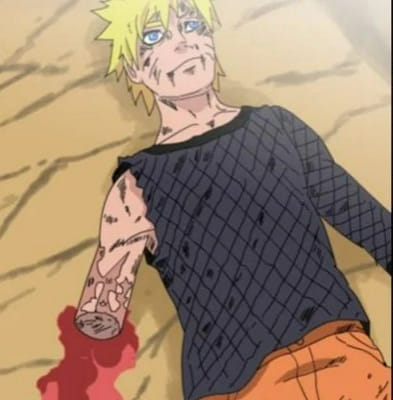 Do You Know Your Naruto? - Test | Quotev