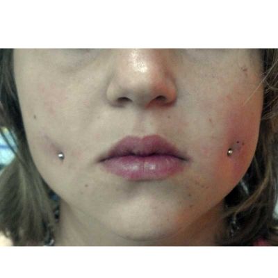 Dimples | What piercing should you try? - Quiz